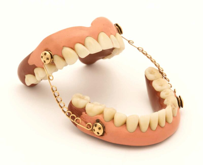 Flame to Furnace: Turning Up the Heat in Dentistry – Page 6 – Virtual ...