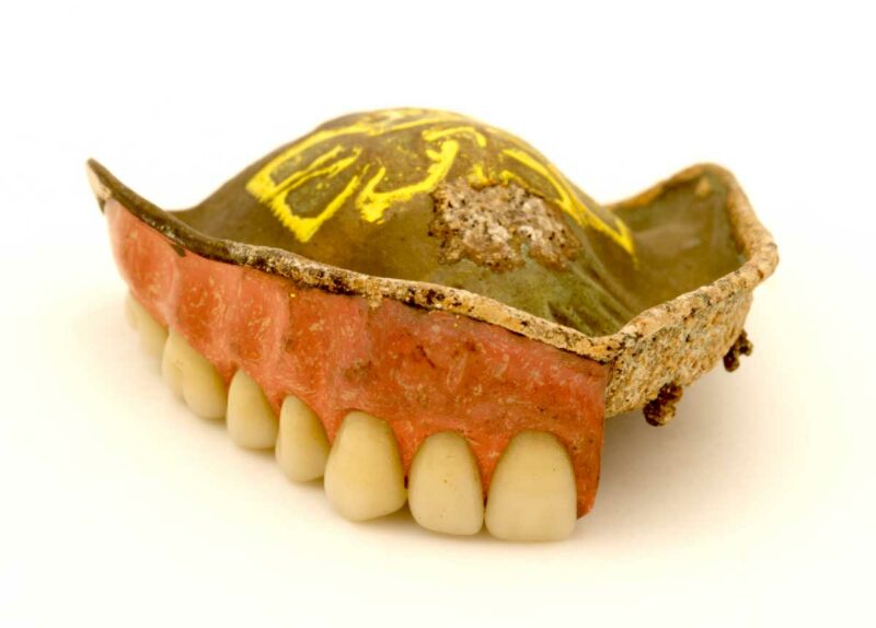 Flame to Furnace: Turning Up the Heat in Dentistry – Page 6 – Virtual ...